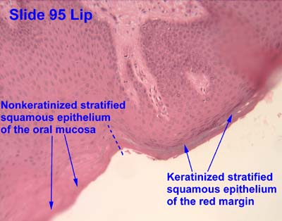 Stratified Squamous Nonkeratinized Epithelium Tongue
